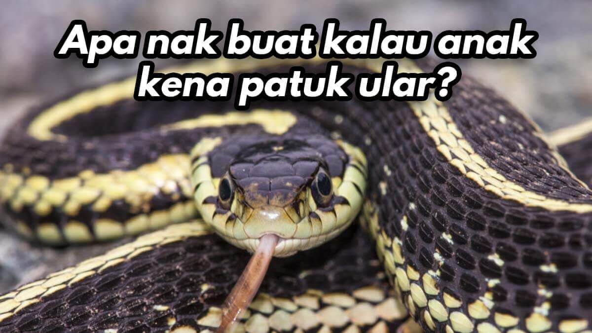 Doktor Kongsikan Perkara Yang Perlu Dibuat Kalau Anak Kena Patuk Ular Doktor Kongsikan Perkara Yang Perlu Dibuat Kalau Anak Kena Patuk Ular
