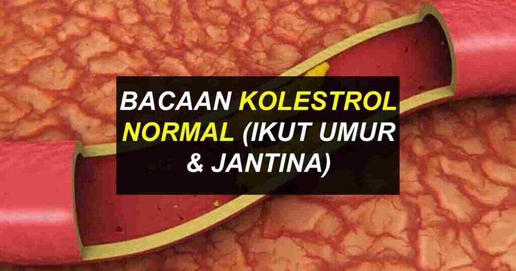 Bacaan Kolestrol Normal Ikut Umur & Jantina